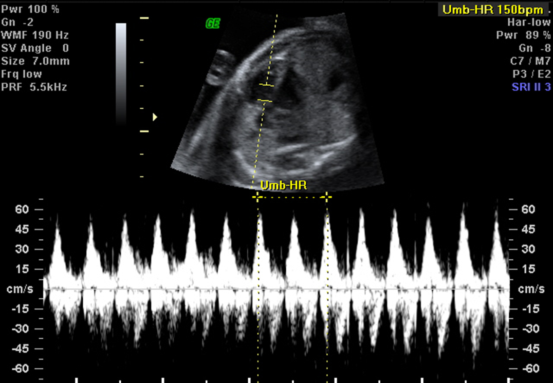 3D-4D-5D ultrahang vizsgálat - 4d Ultrahang Nobilis magánrendelő