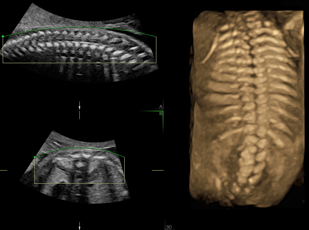 3D-4D-5D ultrahang vizsgálat - 4d Ultrahang Nobilis magánrendelő