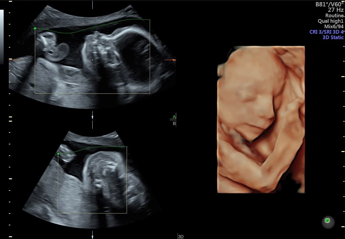 GE Healthcare Voluson E10 típusú ultrahang készülék - 4d Ultrahang ...